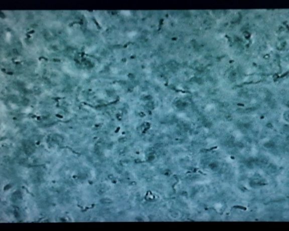 IMG_E0981 | 四日市の歯医者 岩崎歯科 インプラント・入れ歯・矯正歯科・歯周病・予防歯科